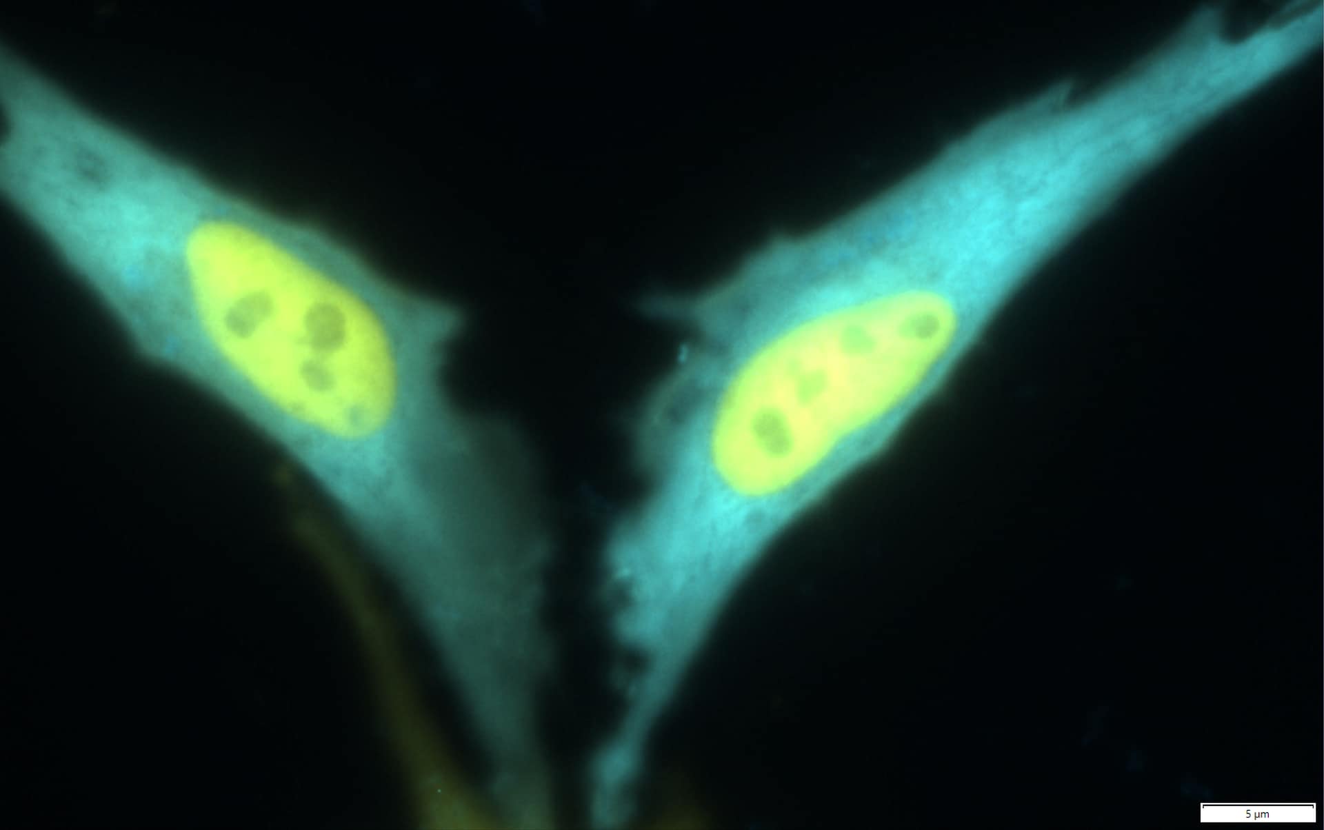 掌握EVIDENT cellSens TruSight 快速改善影像品質 - 元利儀器 | YuanLi