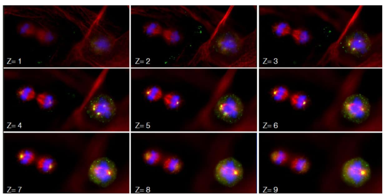 關上蓋子、按個鈕 「套裝」顯微鏡自動對焦取得高階影像 - 元利儀器 | YuanLi